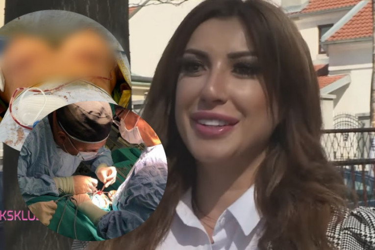 Rebeka Popović pre i posle