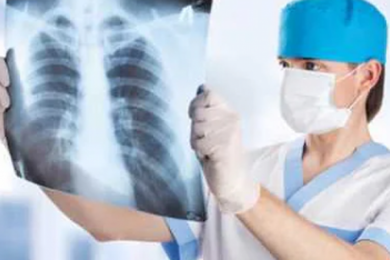 TUBERKULOZA SE VRATILA U SRBIJU! Doktor hitno upozorava: Ako imate OVE ...