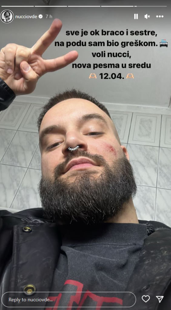 SAV U MODRICAMA! Nući zadobio POVREDE, oglasio se nakon PUCNJAVE na Fristajleru! (FOTO)