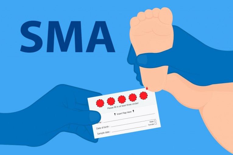 LEPE VESTI: Besplatan skrining na SMA na Biološkom fakultetu obavezan ...