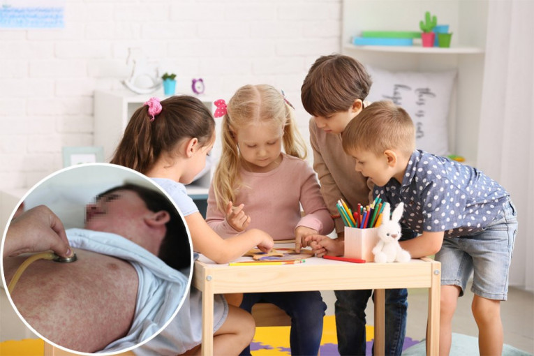 SEDMORO DECE VRTIĆKOG UZRASTA IMA MALE BOGINJE! Stručnjaci apeluju na ...