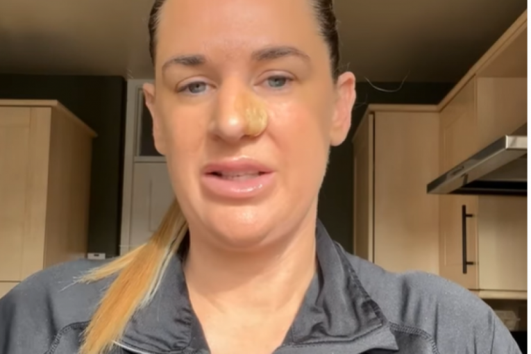 IZ SOLARIJUMA NIJE IZLAZILA SVE DOK JOJ NIJE OSTAVIO RUPU NA LICU: Kada ...