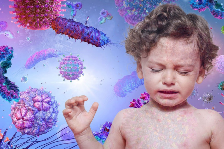 TRI VIRUSA NAM KOSE DECU U VRTIĆIMA! Od "bolesti prljavih ruku" do ...