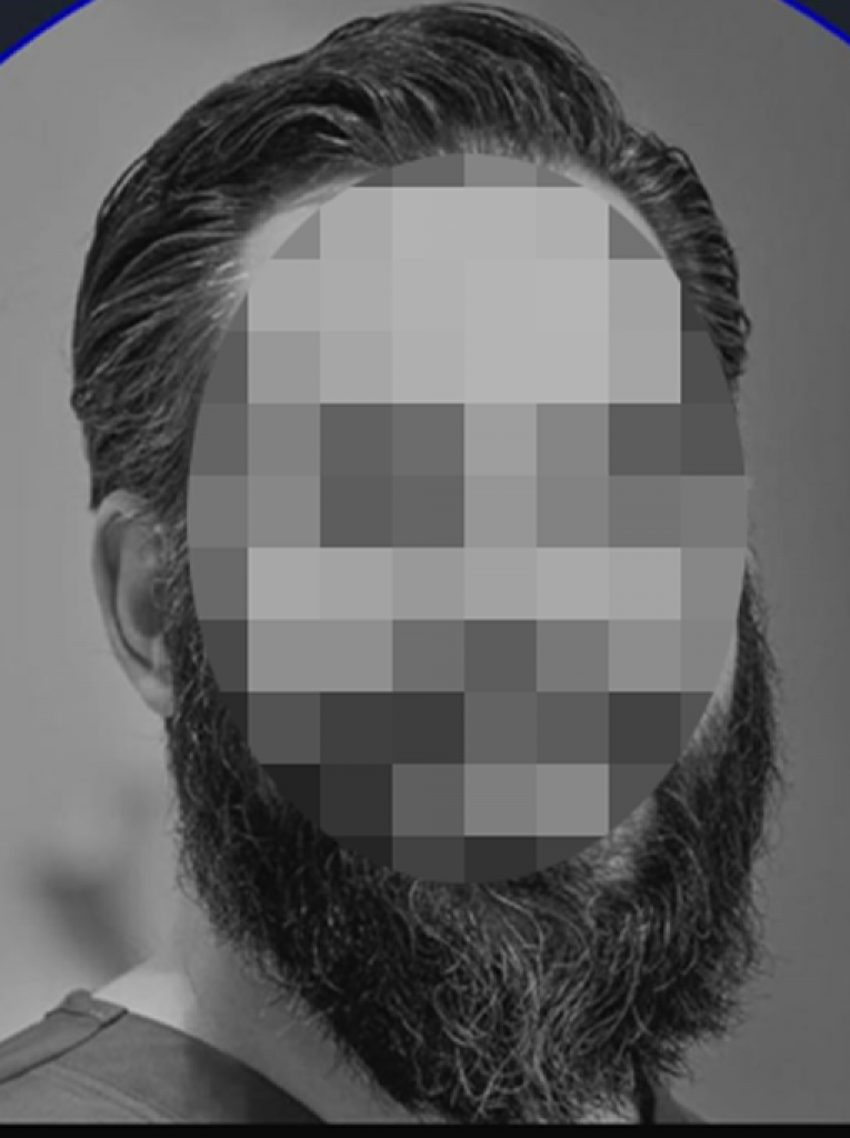 KO ŠTITI DROGIRANOG STOMATOLOGA-UBICU?! Optužen za tešku nesreću u ...