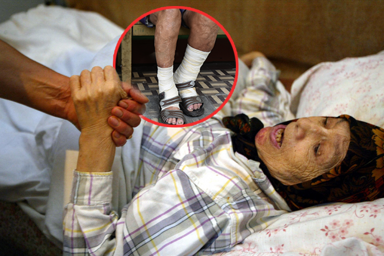 VRATILA SE GUBA U EVROPU! Jeziva bolest pred vratima Srbije!